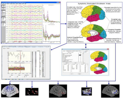 Affordable EEG Analysis and Neurofeedback Software